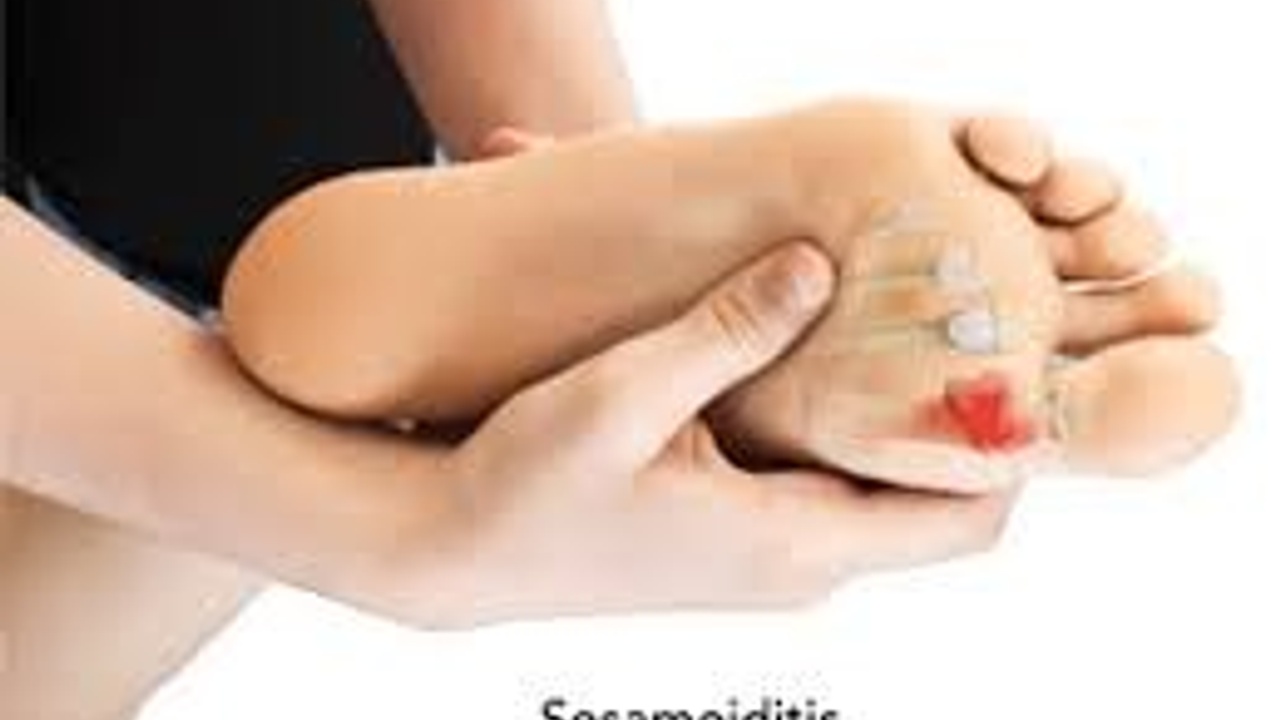 Sesamoiditis
