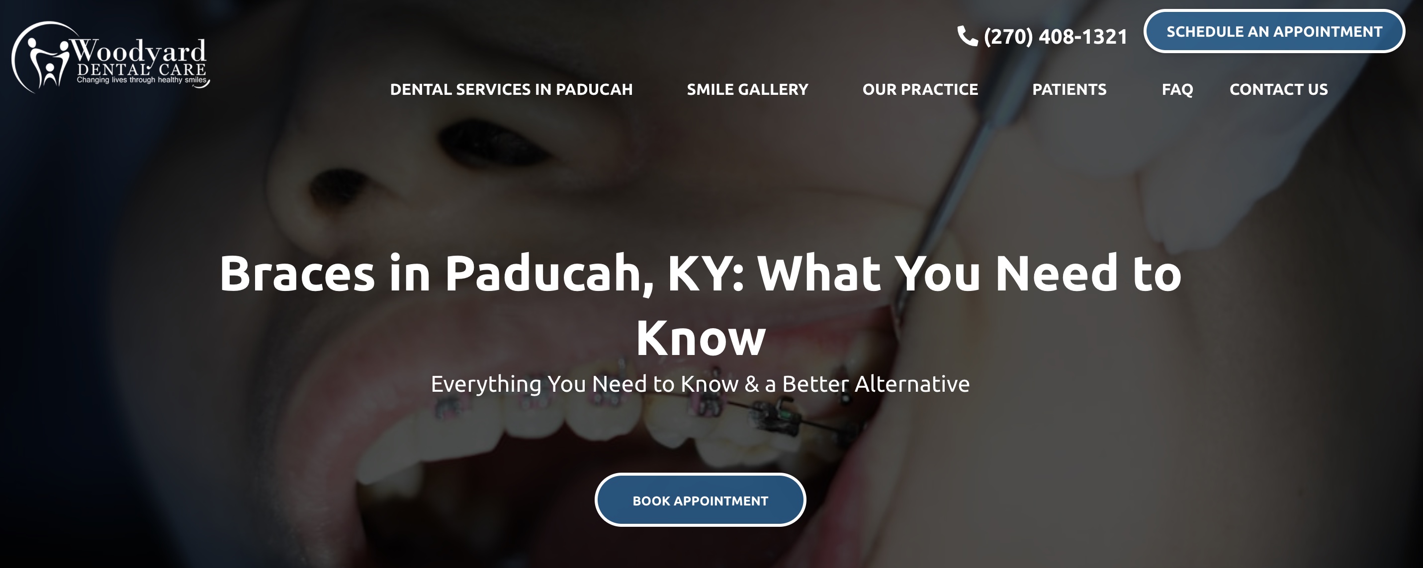 Braces in Paducah, KY | Best Alternative to Braces | Woodyard Dental