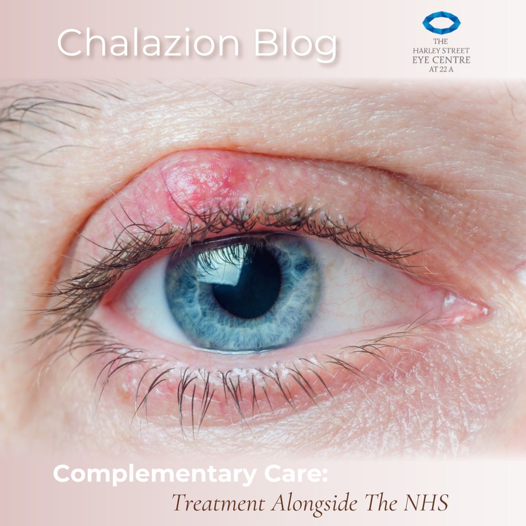 Complementary Care The Role Of Private Chalazion Treatment Alongside