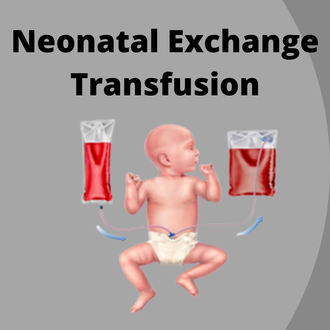 Exchange Transfusions