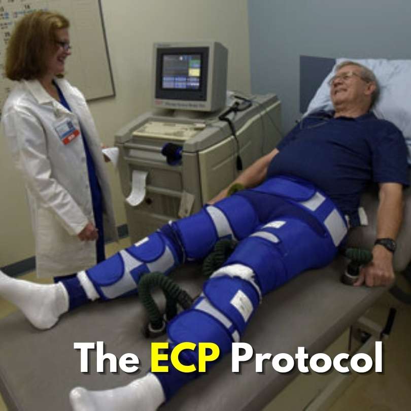 ECP - External Counter Pulsation Therapy