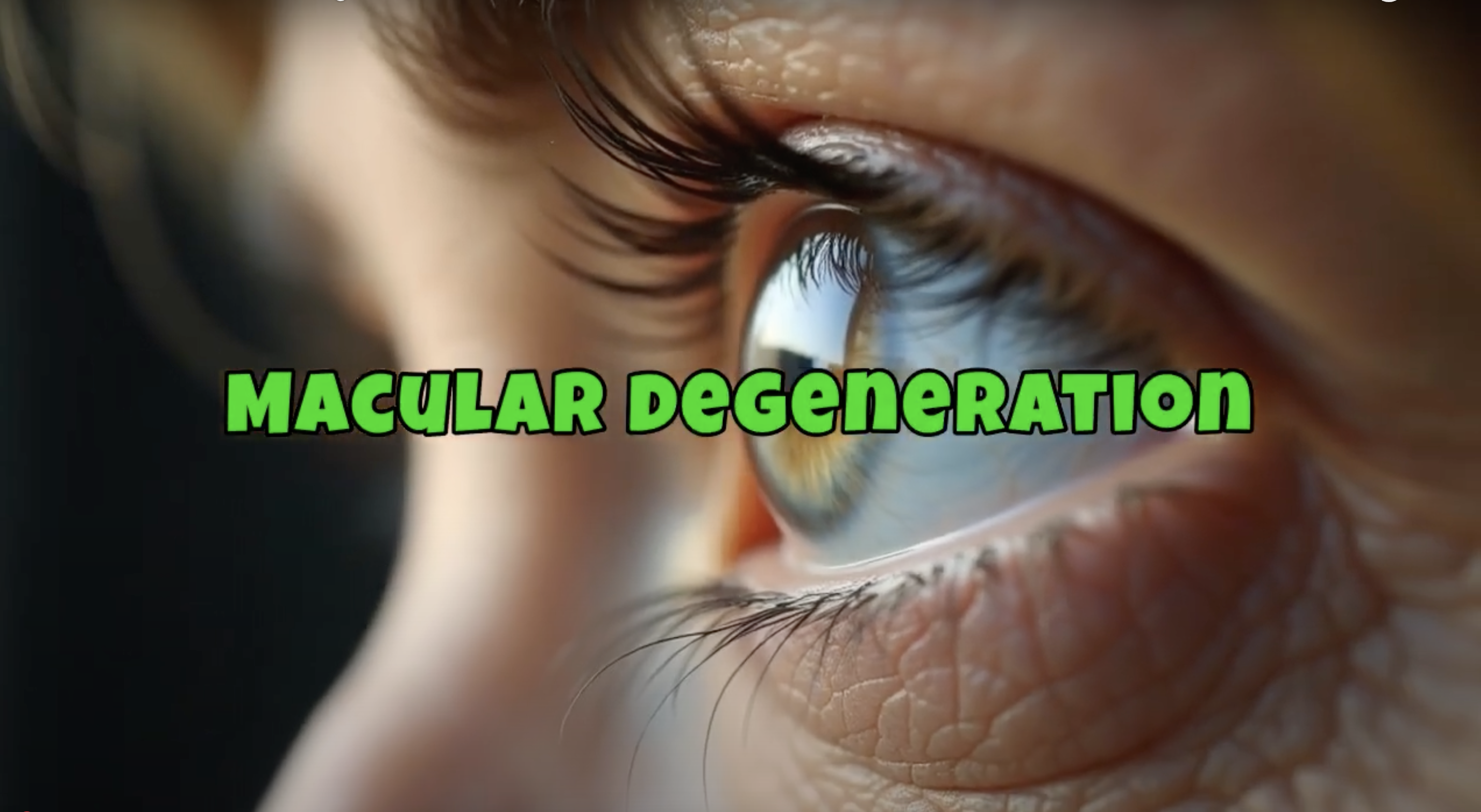 What Causes Macular Degeneration?