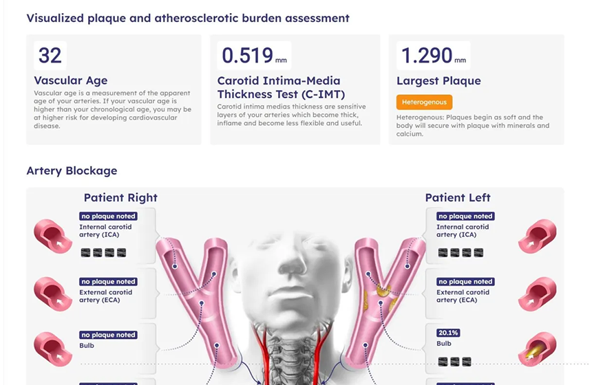 How to Read and Act on Your Cardiovascular Report