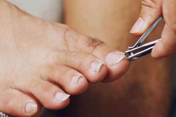 Dealing with Toenail Disorders: When to See a Podiatrist
