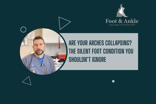 Are Your Arches Collapsing? The Silent Foot Condition You Shouldn’t Ignore