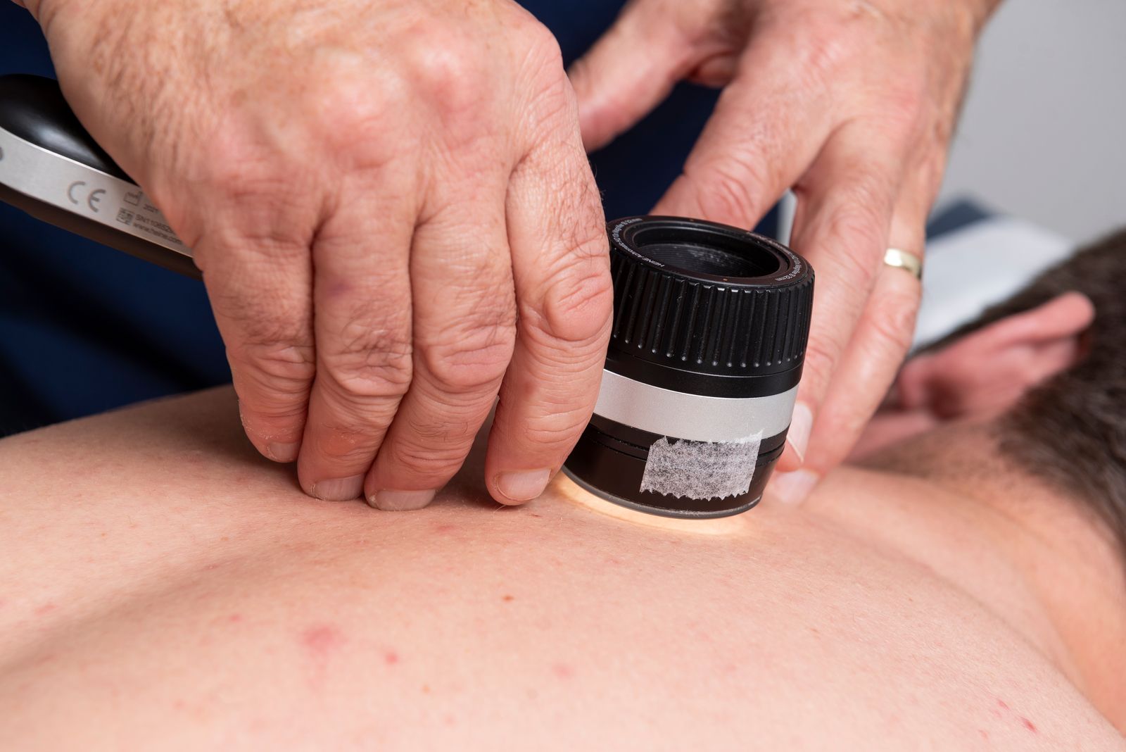 Skin Check Toowoomba | Specialising in Skin Health