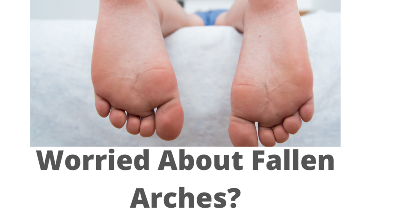 Fallen Arches? Here's Everything You Need To Know