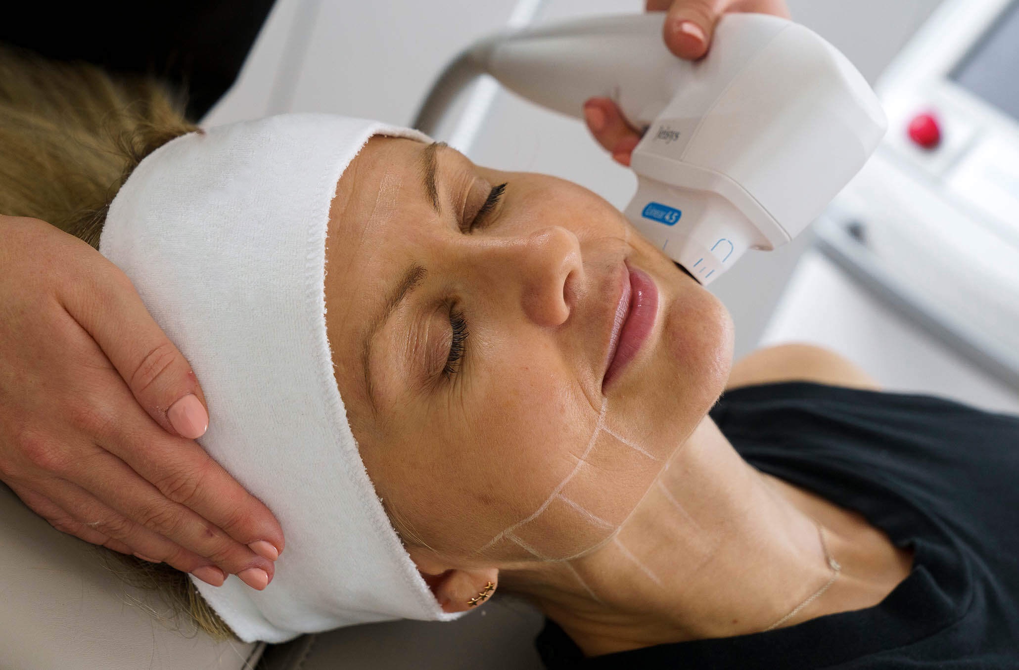 HIFU Full Face and Neck Treatment | Princess Beauty Studio