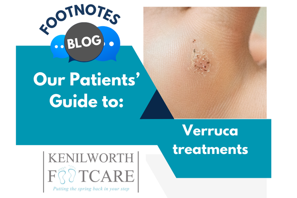 The Complete Guide to Verruca Treatments in Kenilworth: Advanced ...