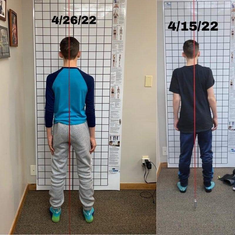 Form and Function Fitness | Posture & Gait Analysis