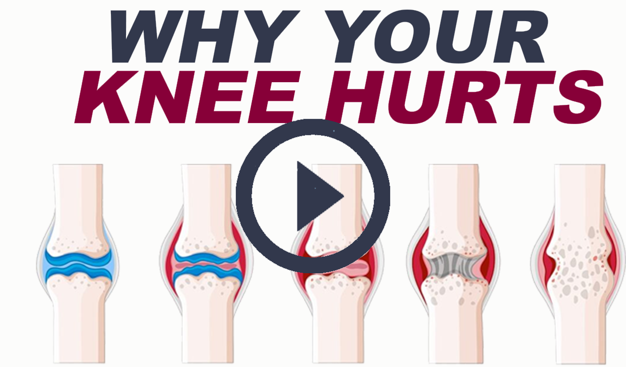 Free Educational Video - Knee Pain Solution
