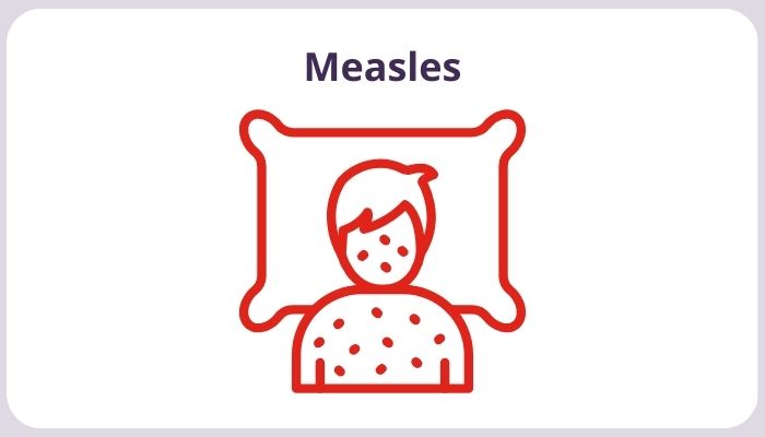 Measles in Early Childhood: Causes, Impacts, and Prevention