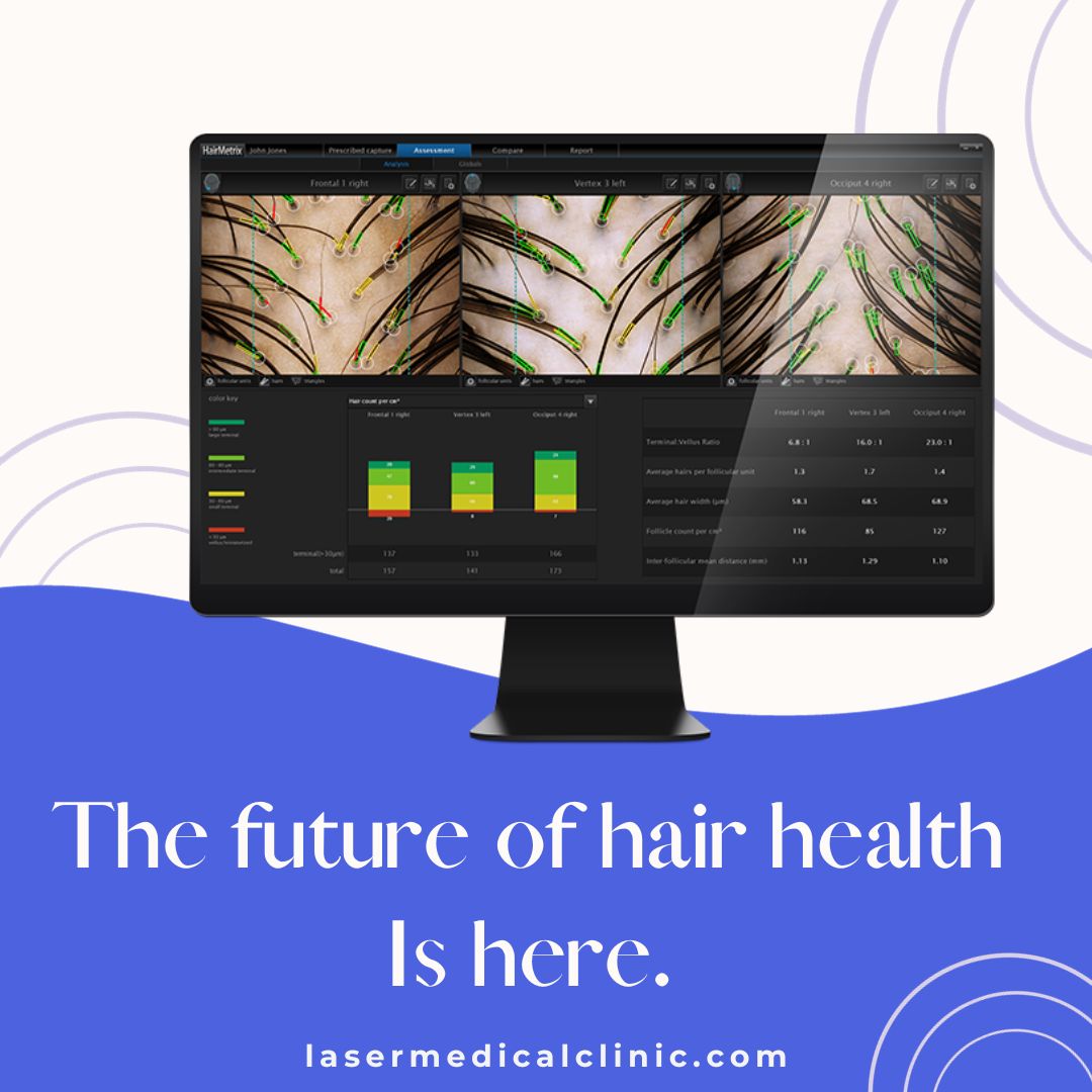 HairMetrix: AI-Driven Trichoscopy for Advanced Hair Analysis | LMC