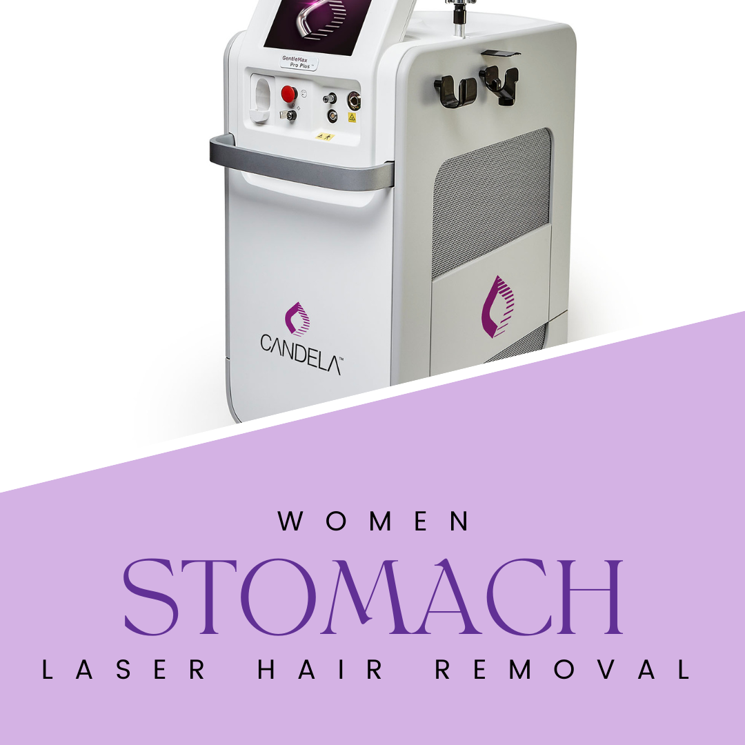 Stomach Laser Hair Removal for Women | GentleMax Pro PLUS | LMC