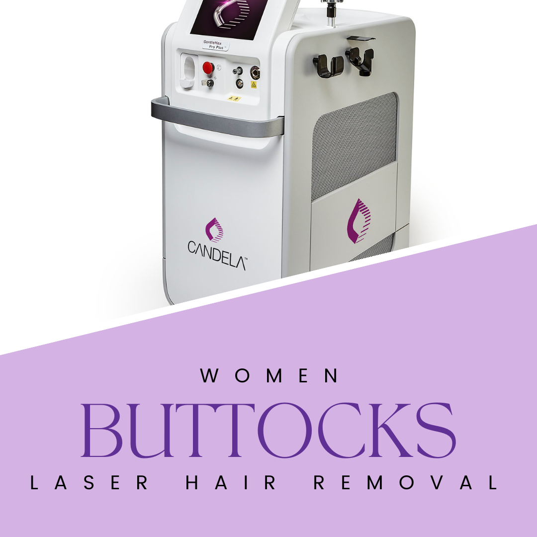 Buttocks Laser Hair Removal for Women | GentleMax Pro PLUS | LMC Clini