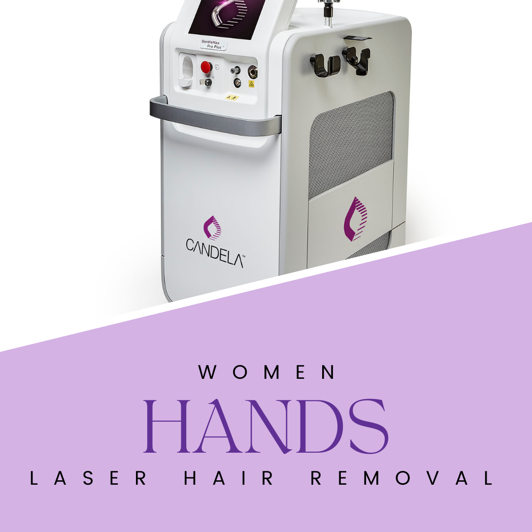 Hand Laser Hair Removal for Women | GentleMax Pro PLUS | LMC Clinic
