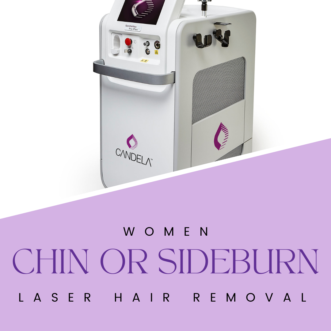 Chin OR Sideburn Laser Hair Removal for Women | GentleMax Pro PLUS